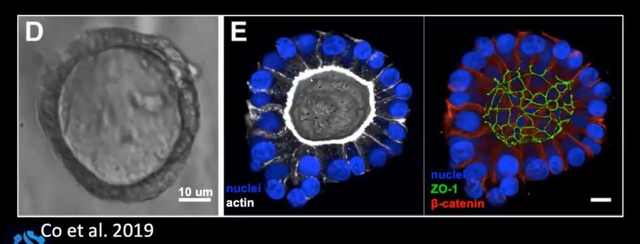 Apical-Out Organoids: A Novel Strategy to Control the Polarity of ...