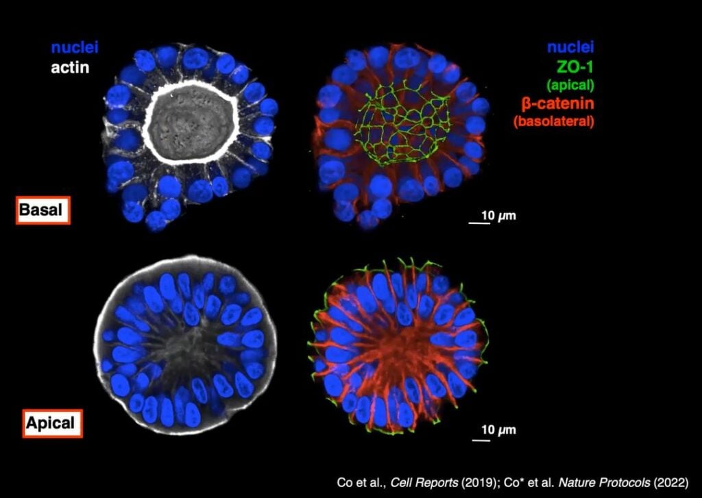 Apical-Out Organoids: A Novel Strategy to Control the Polarity of ...